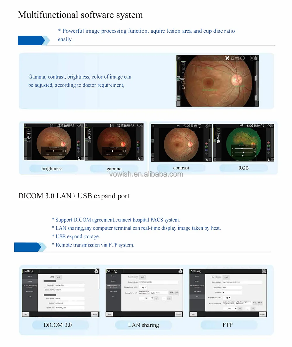 Reticam-3100 Ophthalmic Retinal Camera - Non-Mydriatic Fundus Camera by ...
