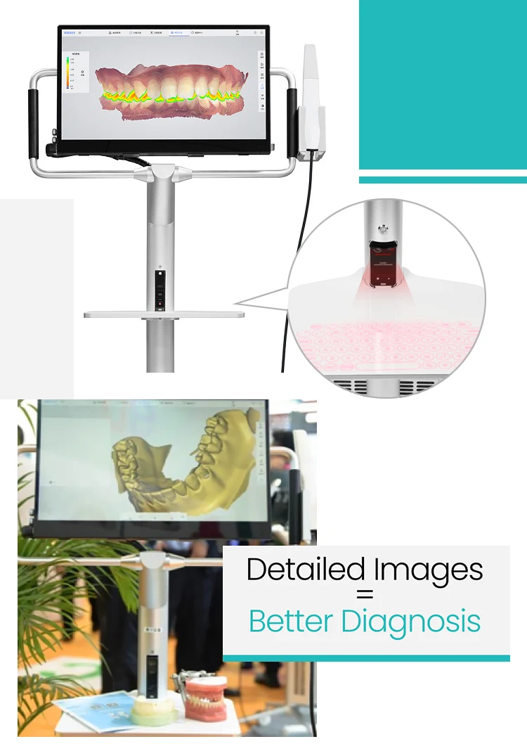 Easy Usability Intraoral 3d Scanner High-end Nice Looking Dental ...