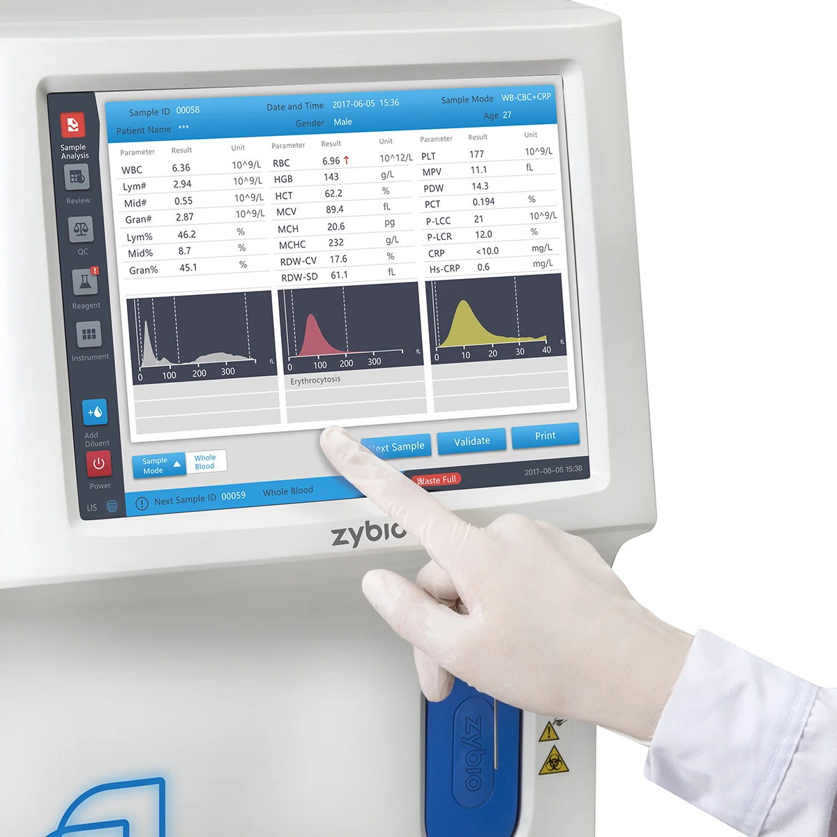 Alibaba.com: Zybio Z3 3-part Hematology Analyzer with reagent included; CE, BV, and ISO ...
