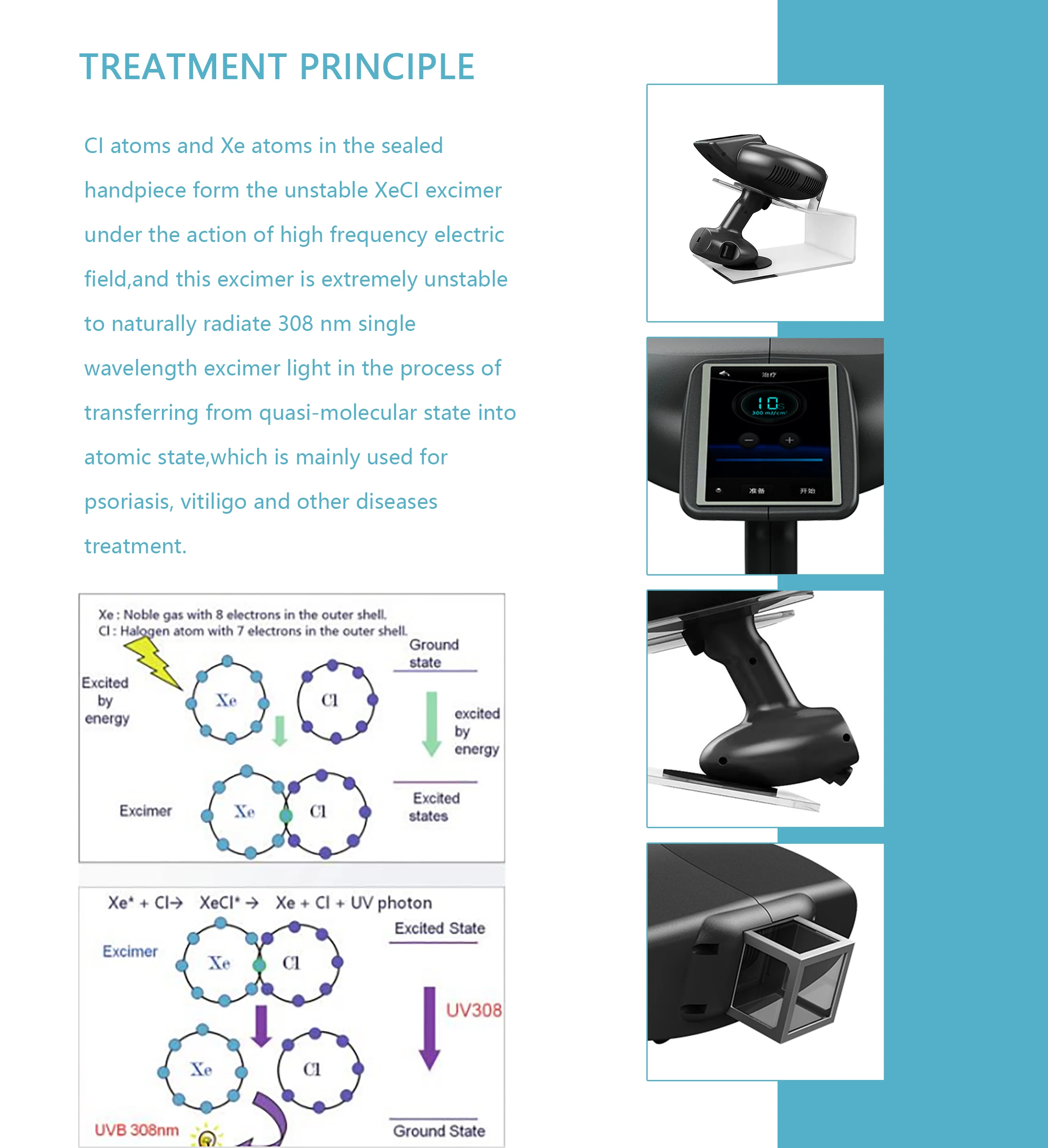 Handheld Designed Excimer System Mobile for Psoriasis Eczema 308nm ...