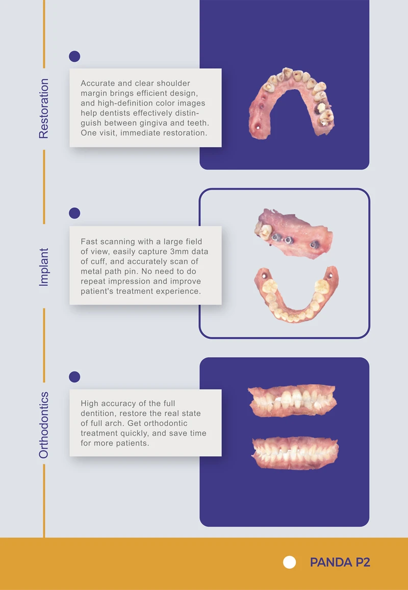 Dental Panda Intraoral 3d Scanner Digital Panda P2 Intra Oral Scanner ...