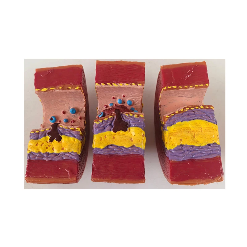 Realistic Artery Atherosclerosis Model 7-Segment | Lab & Medical ...
