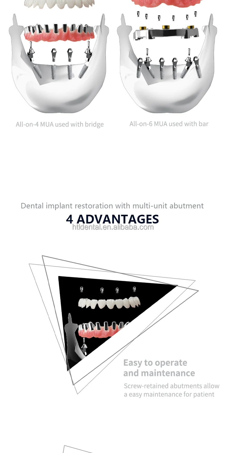 Astra Implant Compatible Dental Straight Multi-unit Abutment| Alibaba.com
