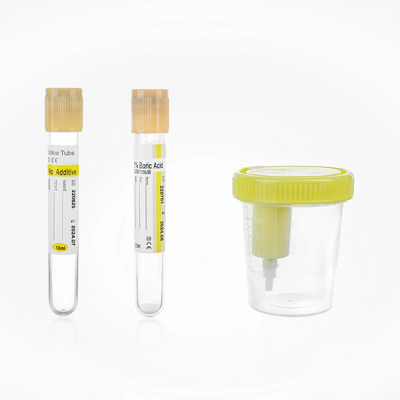 Medical Disposable Vacuum Urine Collection Tube Urine Sample Container ...