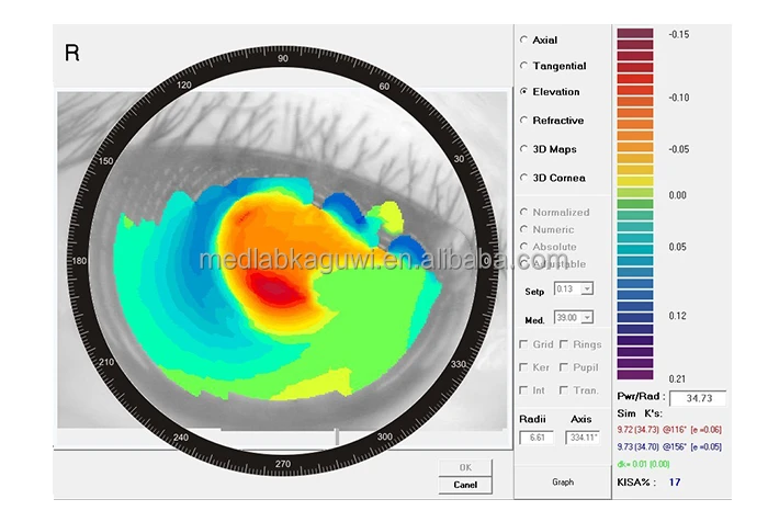 Corneal Topographer - Precision in Optometry & Ophthalmology