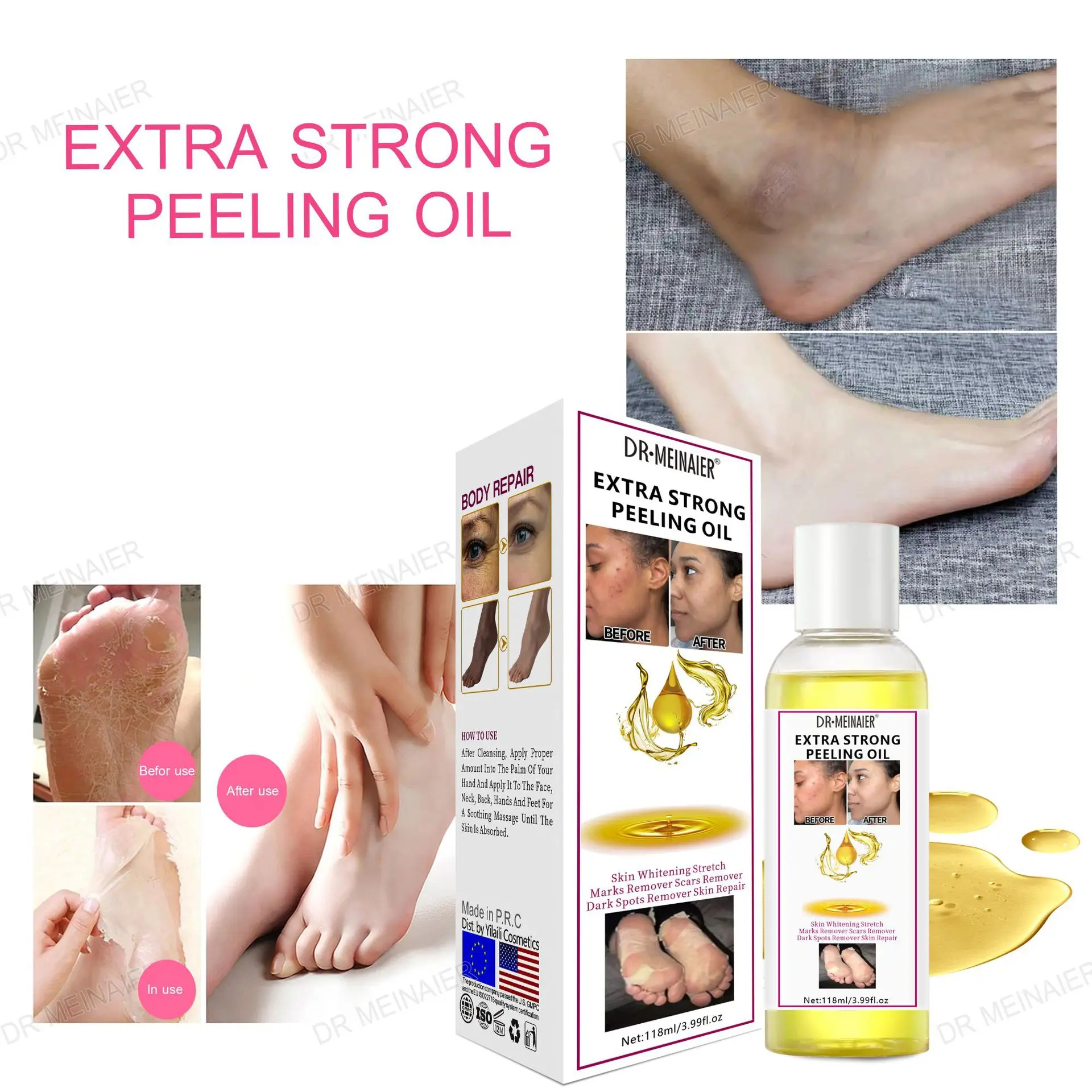 Lightening Yellow-peeling-oil Clears Dark Spot Peeling Oil Face Strong ...
