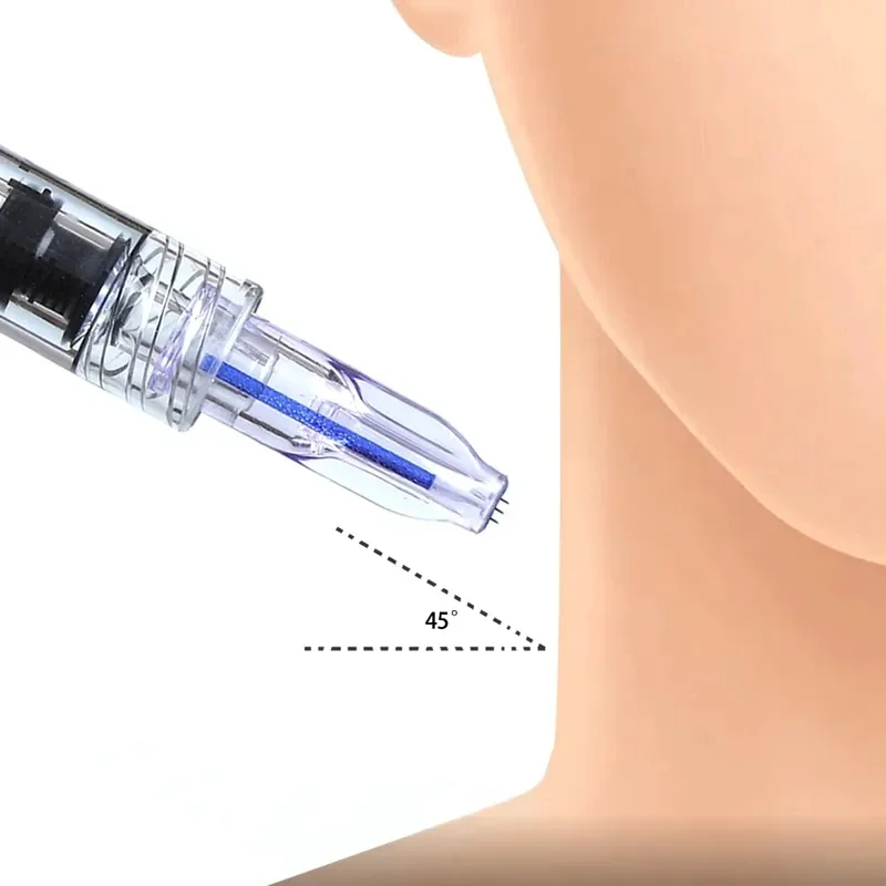 Nanosoft Microneedles Fillmed 3 Pin Needle 34g 1.0mm 1.2mm 1.5mm ...