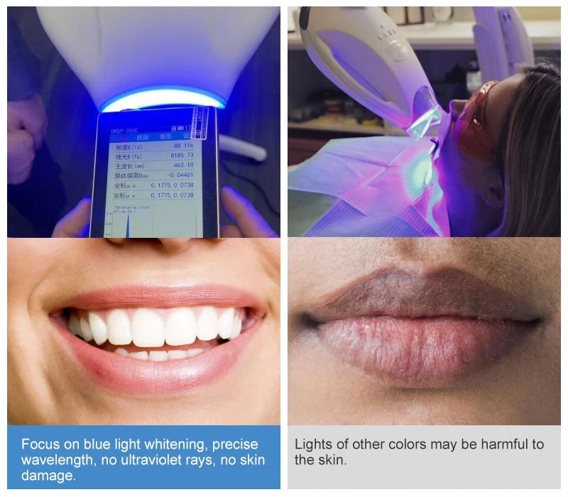 Professional Dental Bleaching Laser - Portable Teeth Whitening Lamp