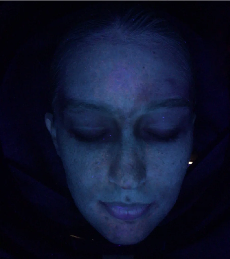 MEICET MC10 Skin Analyzer - Professional Facial Care Tool