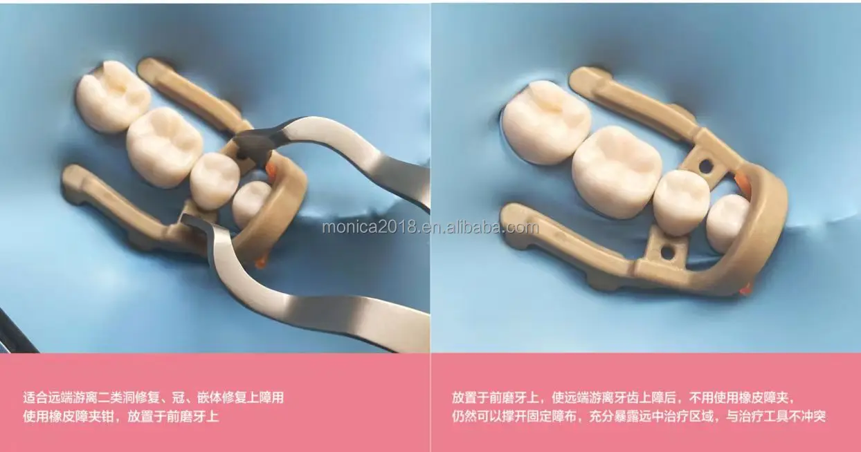 Dental Rubber Dam Clamp / Dental Restorative Instruments/distal ...