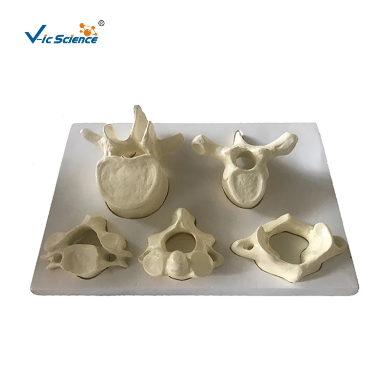 Vertebrae Collection Plastic Pelvis Model Female Pelvic Anatomical ...