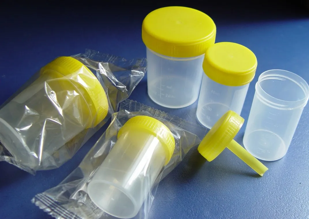 Sputum Specimen Container Factory And Sterile Stool Sample Container ...