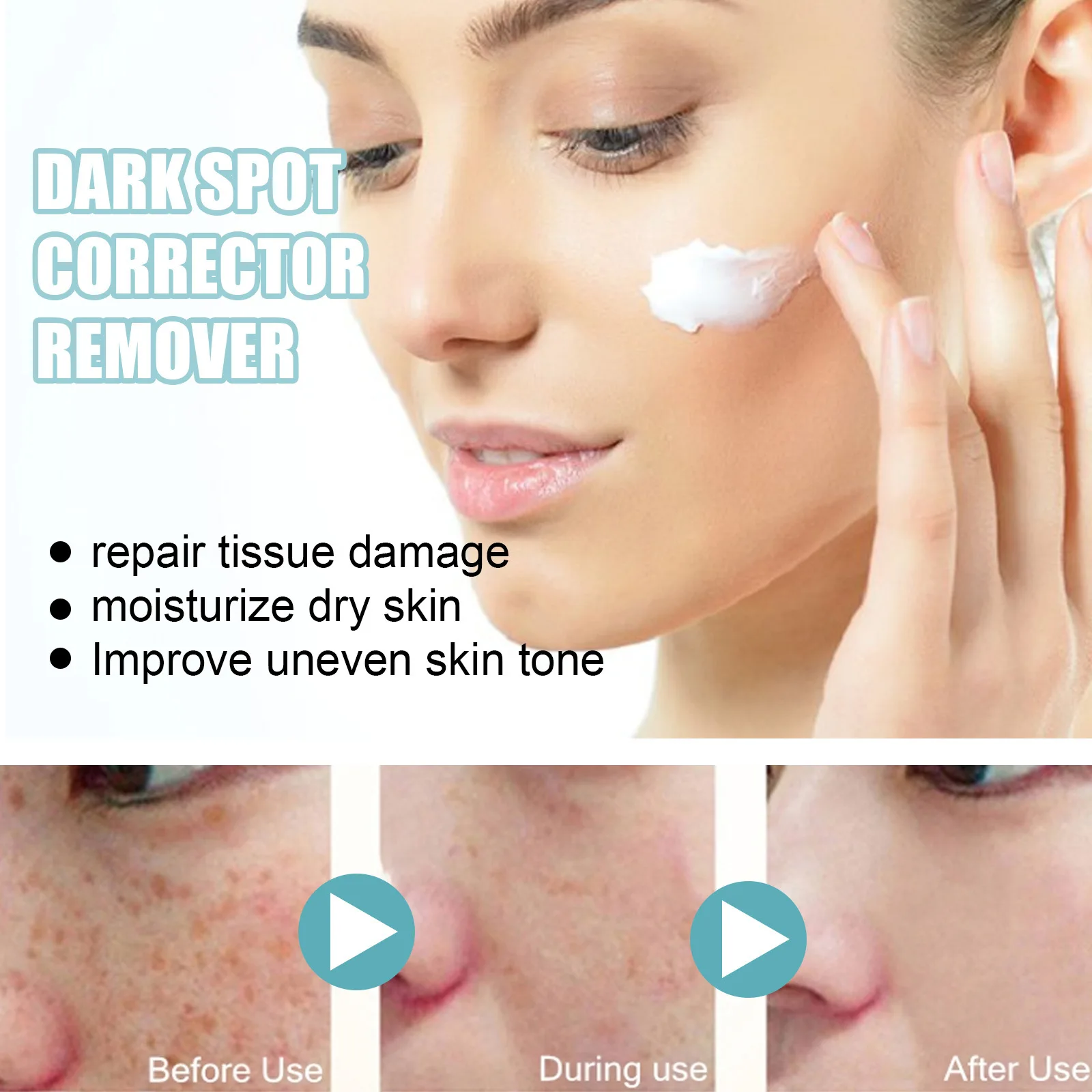 Dark Spot Corrector Cream Melasma Treatment for Face Hyperpigmentation Treatment Freckle Remover ...