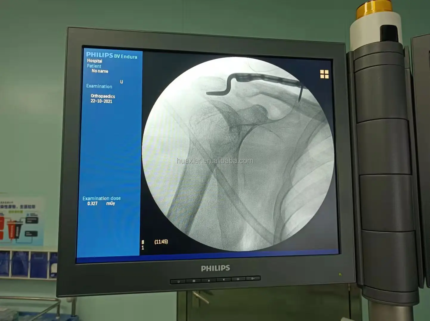 Fluoroscopy Radiolucent Imaging OT Table - Carbon Fiber