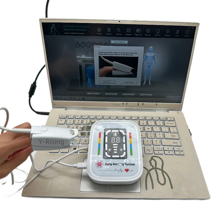 Finger Quantum Bioresonance Analyzer 53 Report Body Biomagne-阿里巴巴