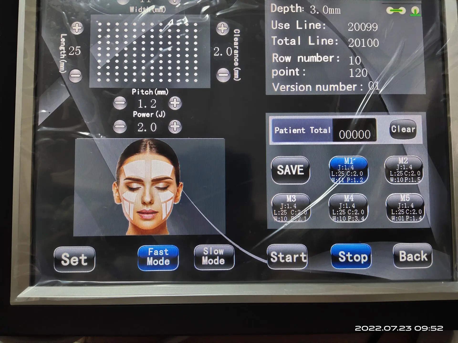 Professional 2in1 4d Vmax 12 Lines High Intensity Focused Machine Skin ...