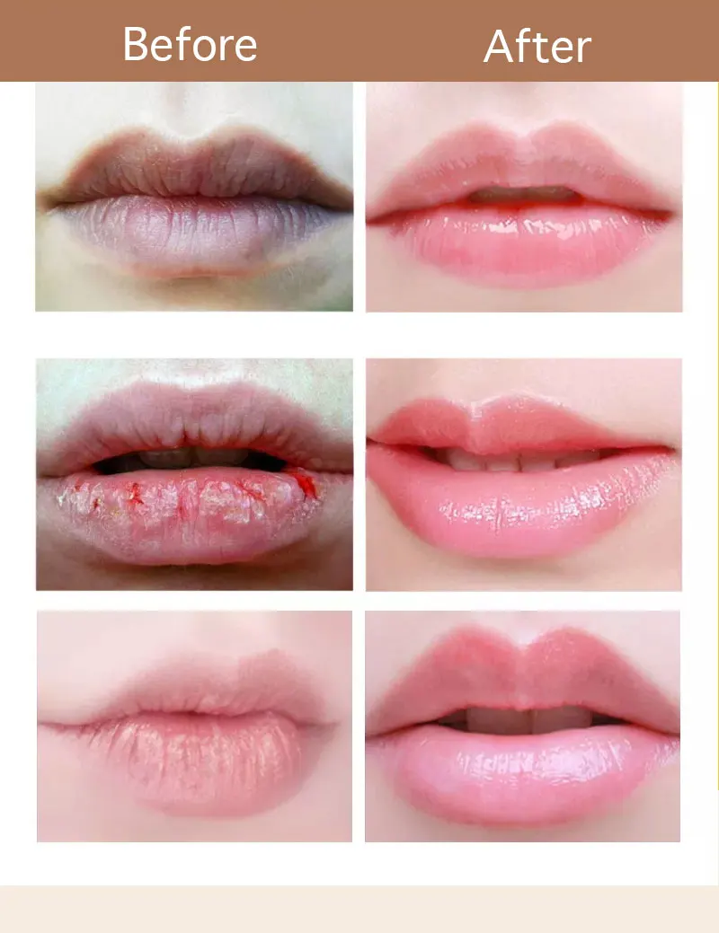 Custom New Small Cute Pink Moisturizing OEM Lip Balm