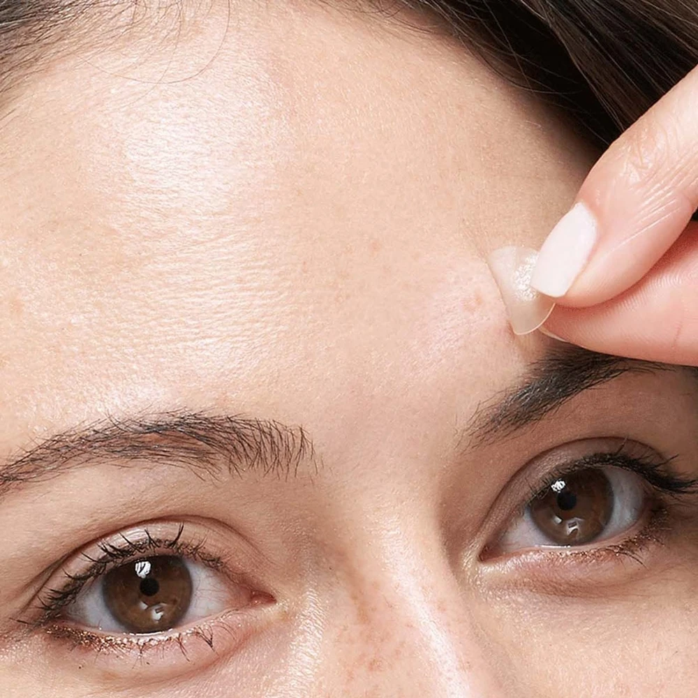 Skincare Anti Acne Patch Hydrocolloid Pimple Spot Stickers - Buy ...