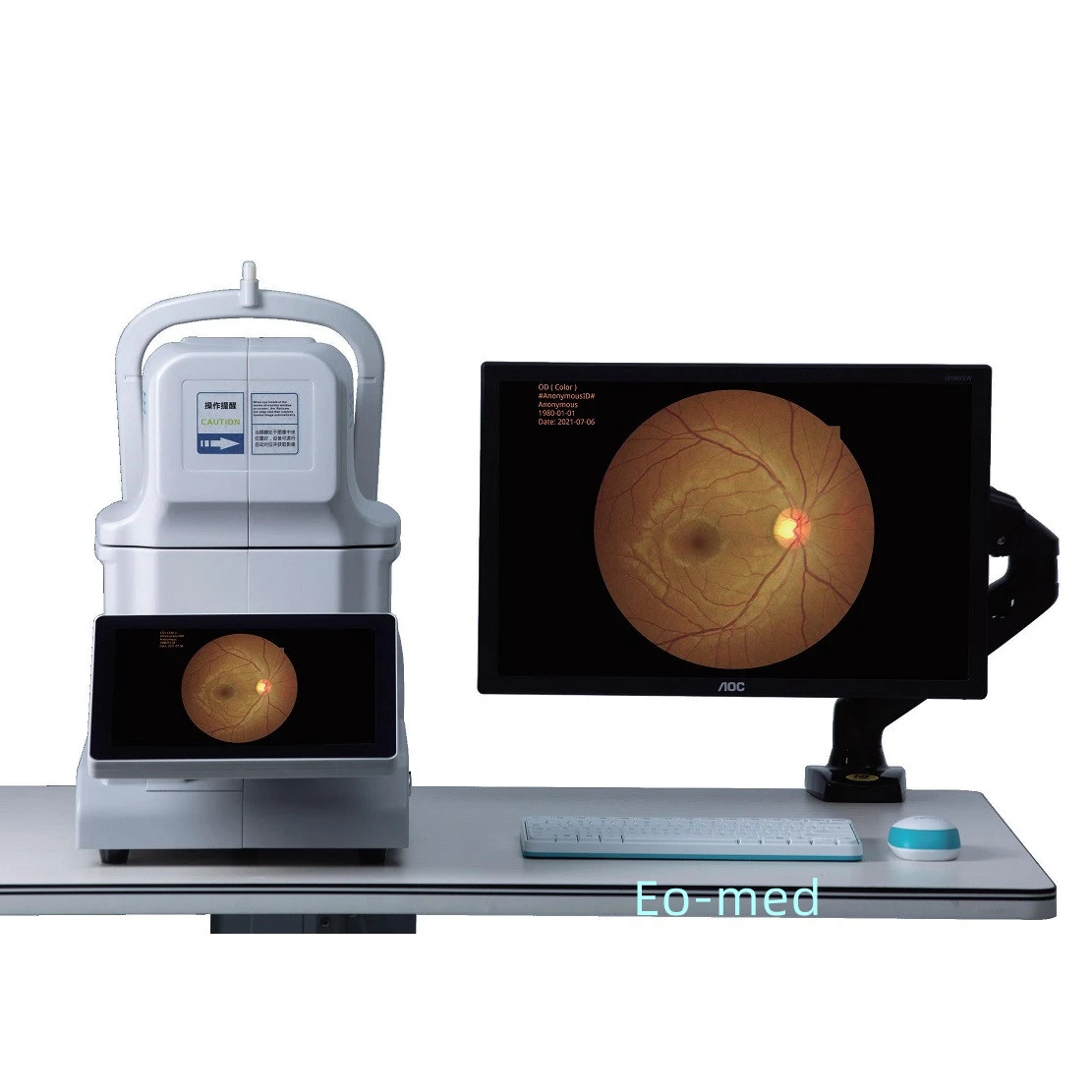 Laser Ophthalmic Fundus Camera Digital Non-mydriatic Fundus Camera New ...