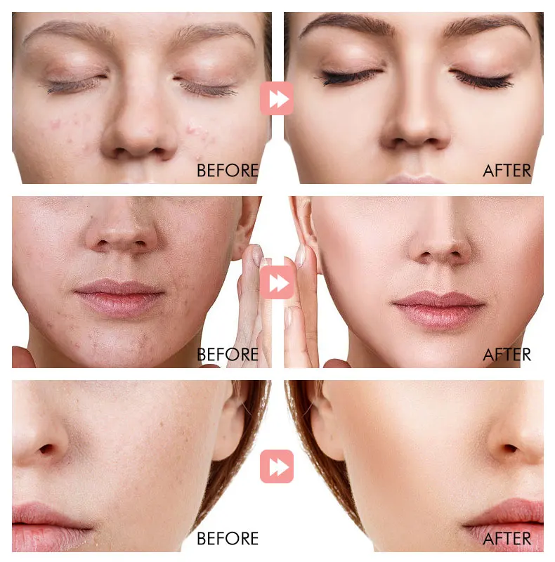 Biosphere 4 in 1 Brightening Skin Care Kit Moisturizing Oil Control ...