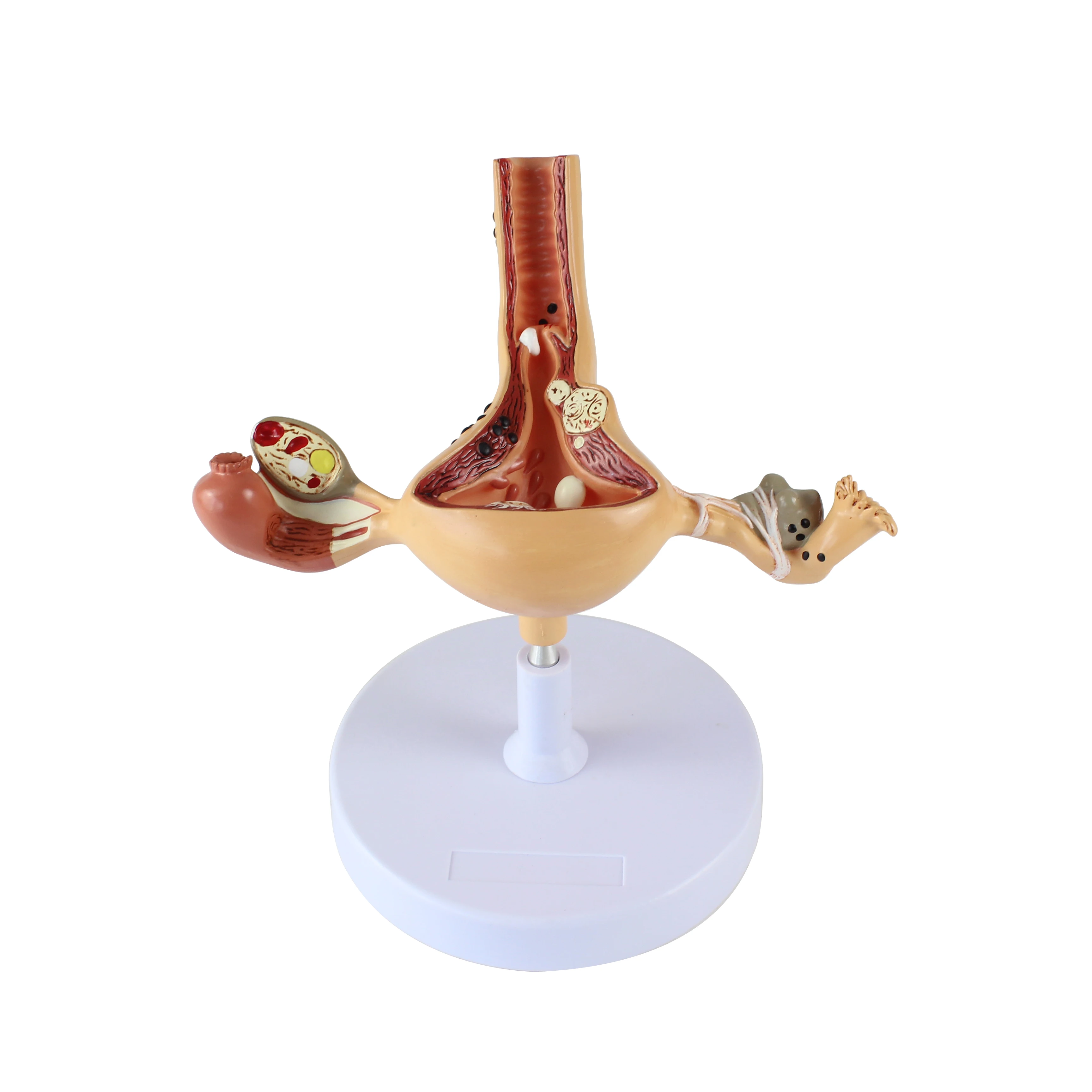 Factory Human Anatomical Pathology Uterus Model of Medical Science ...