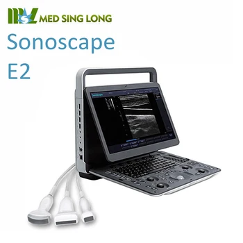 Medical Portable Sonoscape E2 3d 4d Digital Color Doppler Ob/gyn ...