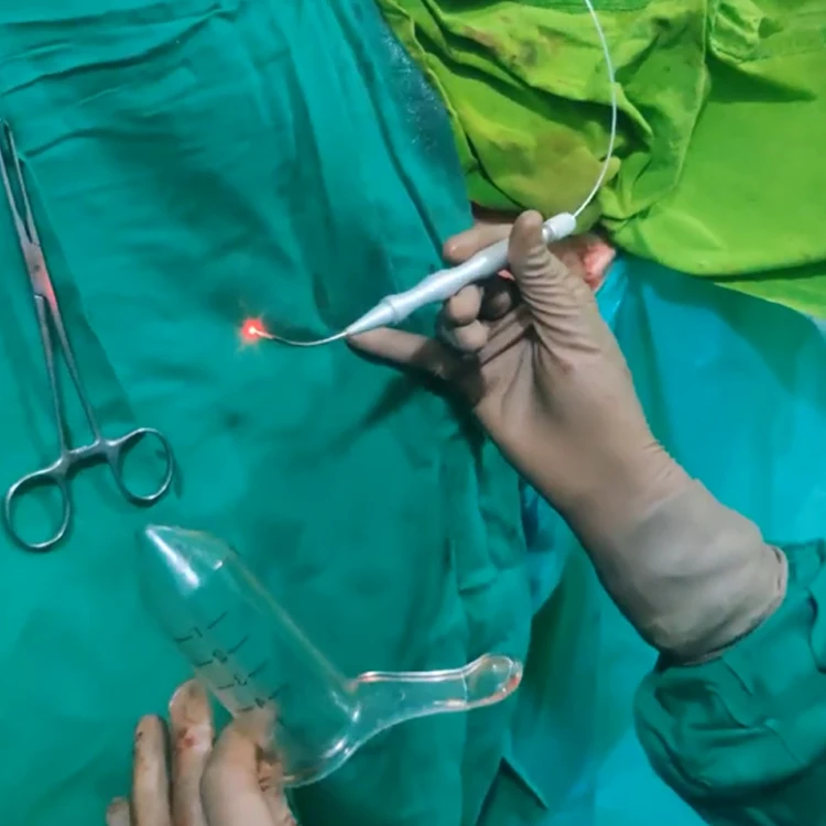 Alibaba.com: 2025 Newest 980nm/1470nm Diode Laser Proctology Surgical ...