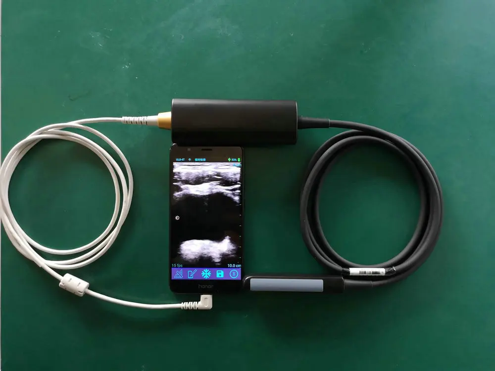 Rectal Portable Veterinary Ultrasound Machine for Cow Cattle Horse ...