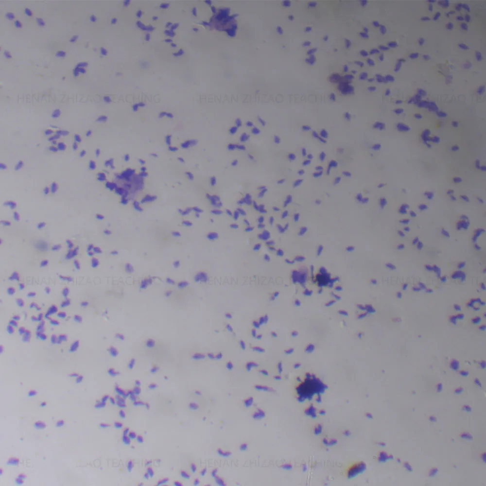 Trichomonas Vaginalis Smear - Educational Microscope Slides