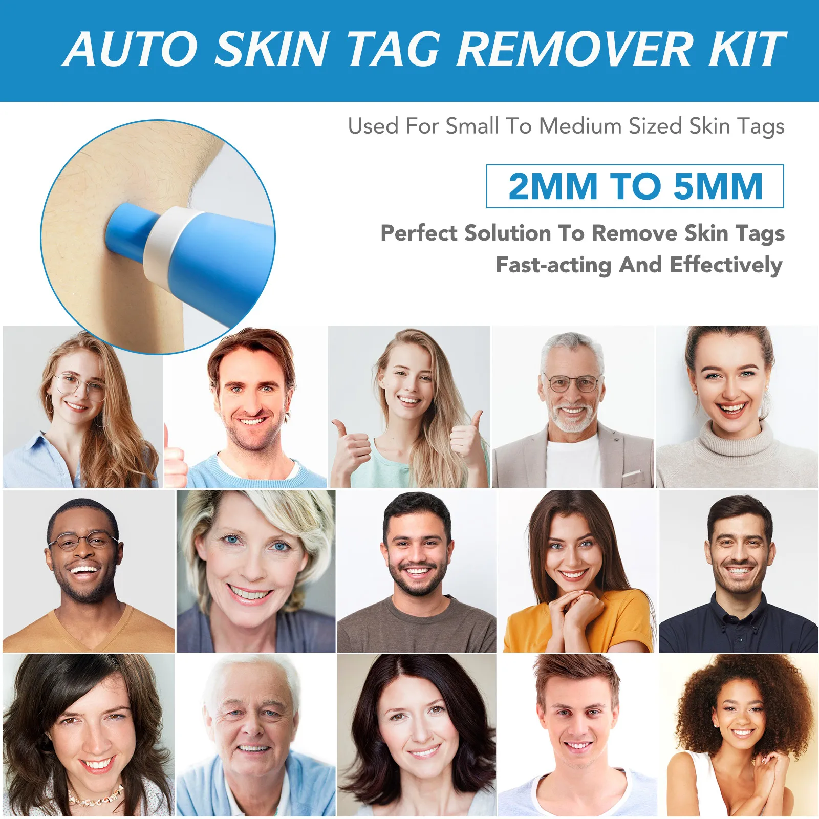 ALIVER Skin Tag Removal Kit - Safe and Efficient Solutions