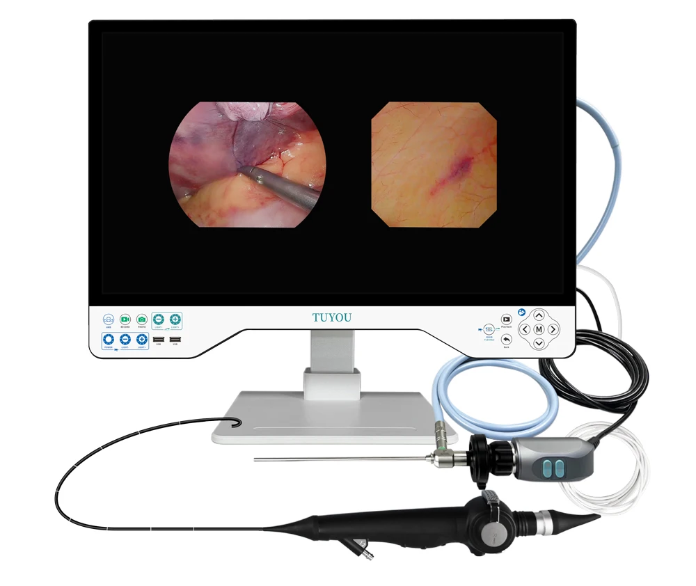 Trust Suppliers Full HD 4K Endoscope System Rigid and Flexible 24 ...