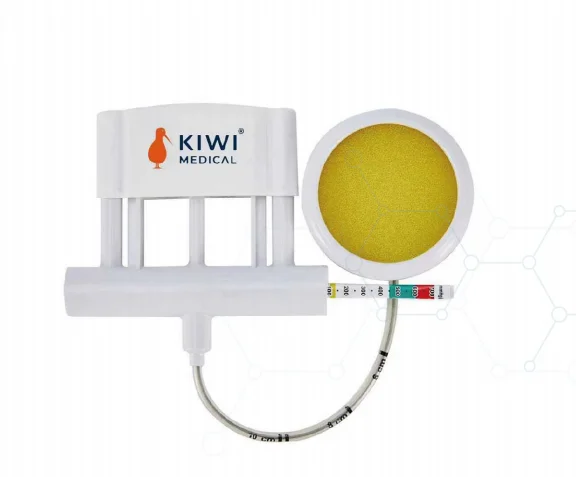 Safety And Effectiveness Kiwi Disposable Vacuum Assisted Fetal Delivery ...