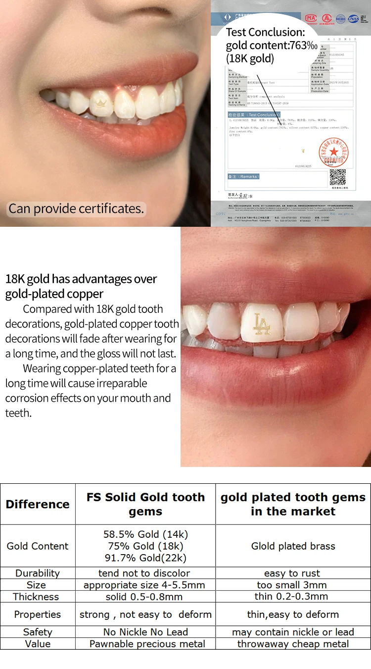 Gold Tooth Gems - Custom Dental Jewelry by Forever Star