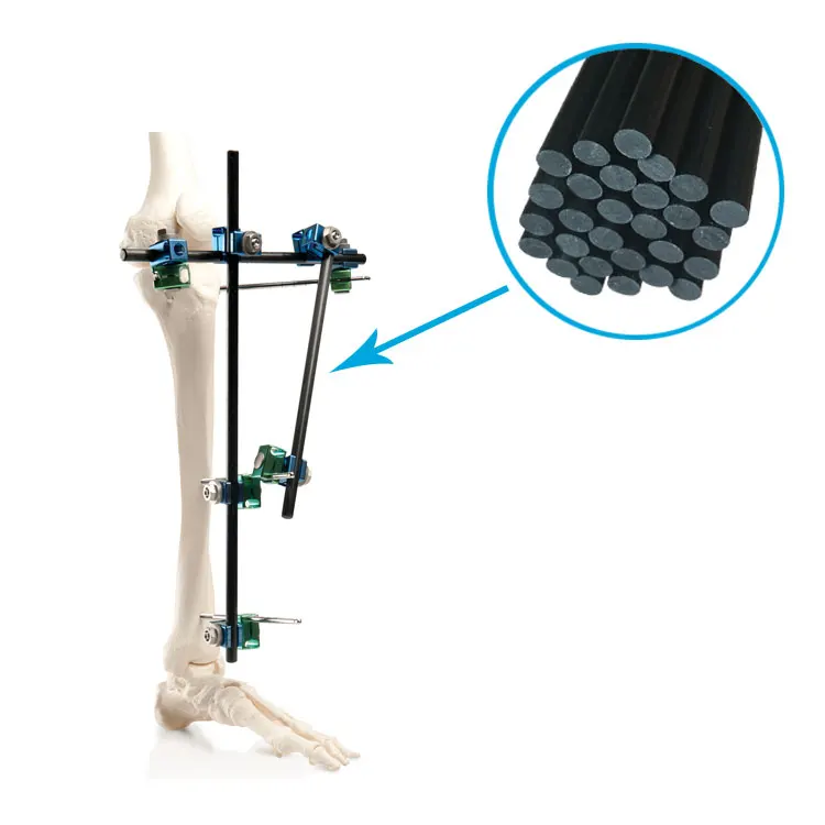 Orthopedic External Fixator Carbon Fibre Tubular Rod With 4mm 5mm 8mm ...