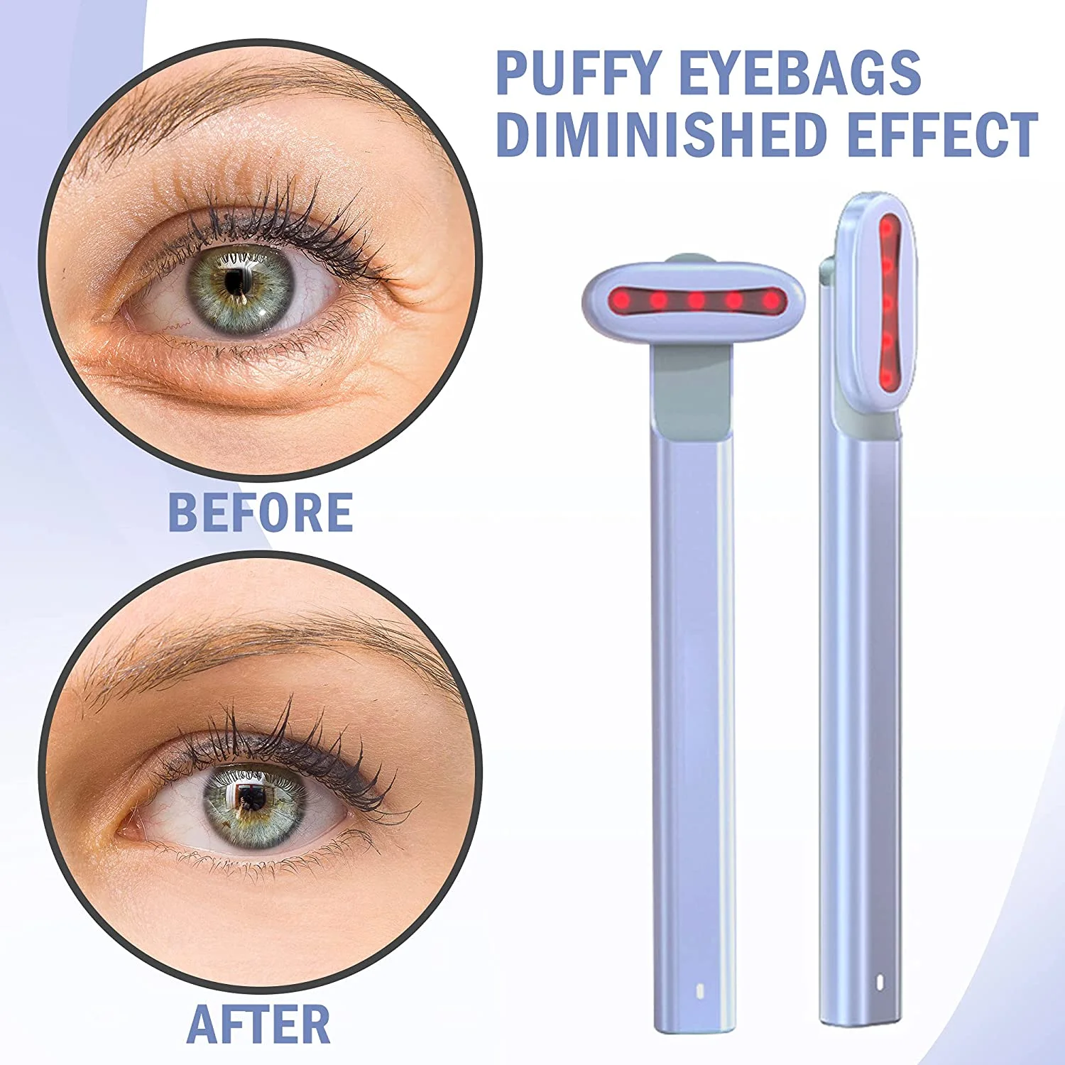 4-in-1 Skincare Wand Rechargeable Vibrating Ems Microcurrent Red Light ...