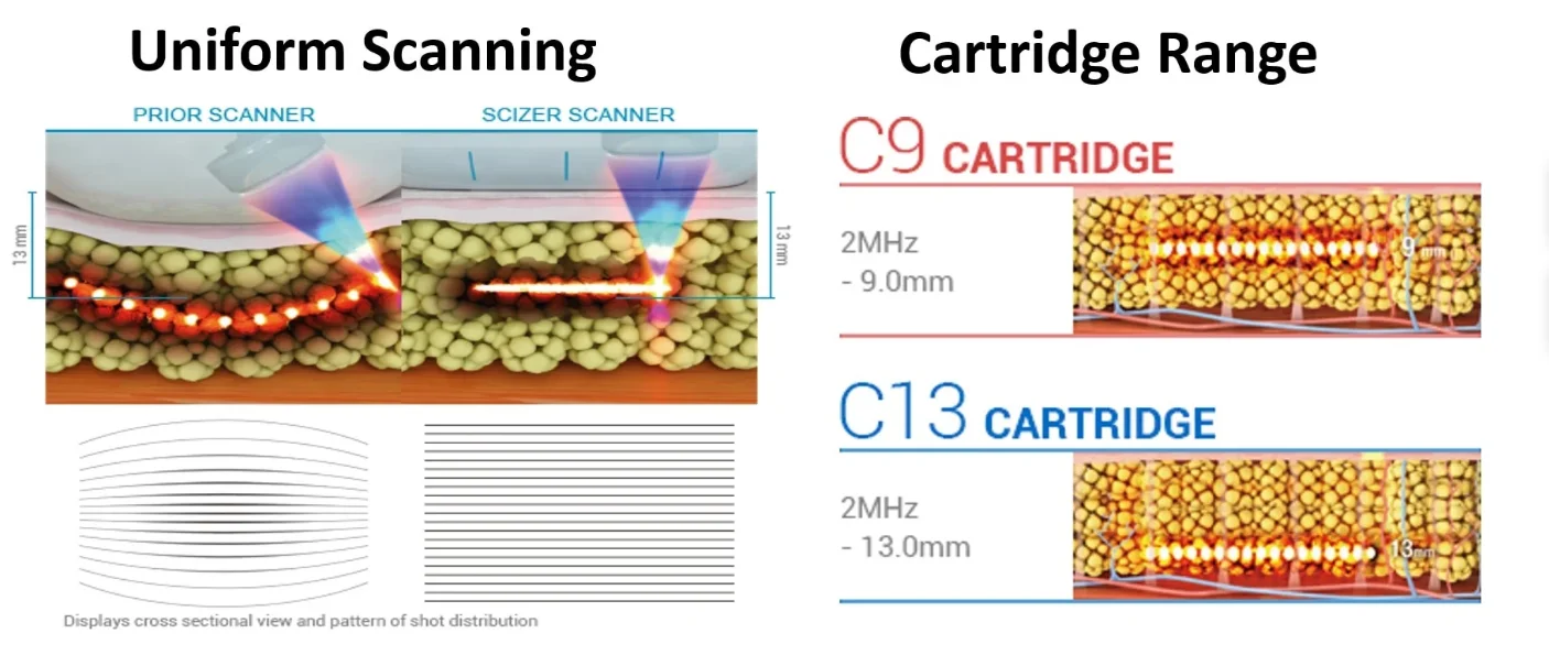 2026 Newest MFSU Macro Focused Scanning ultra Slimming Machine for Skin ...