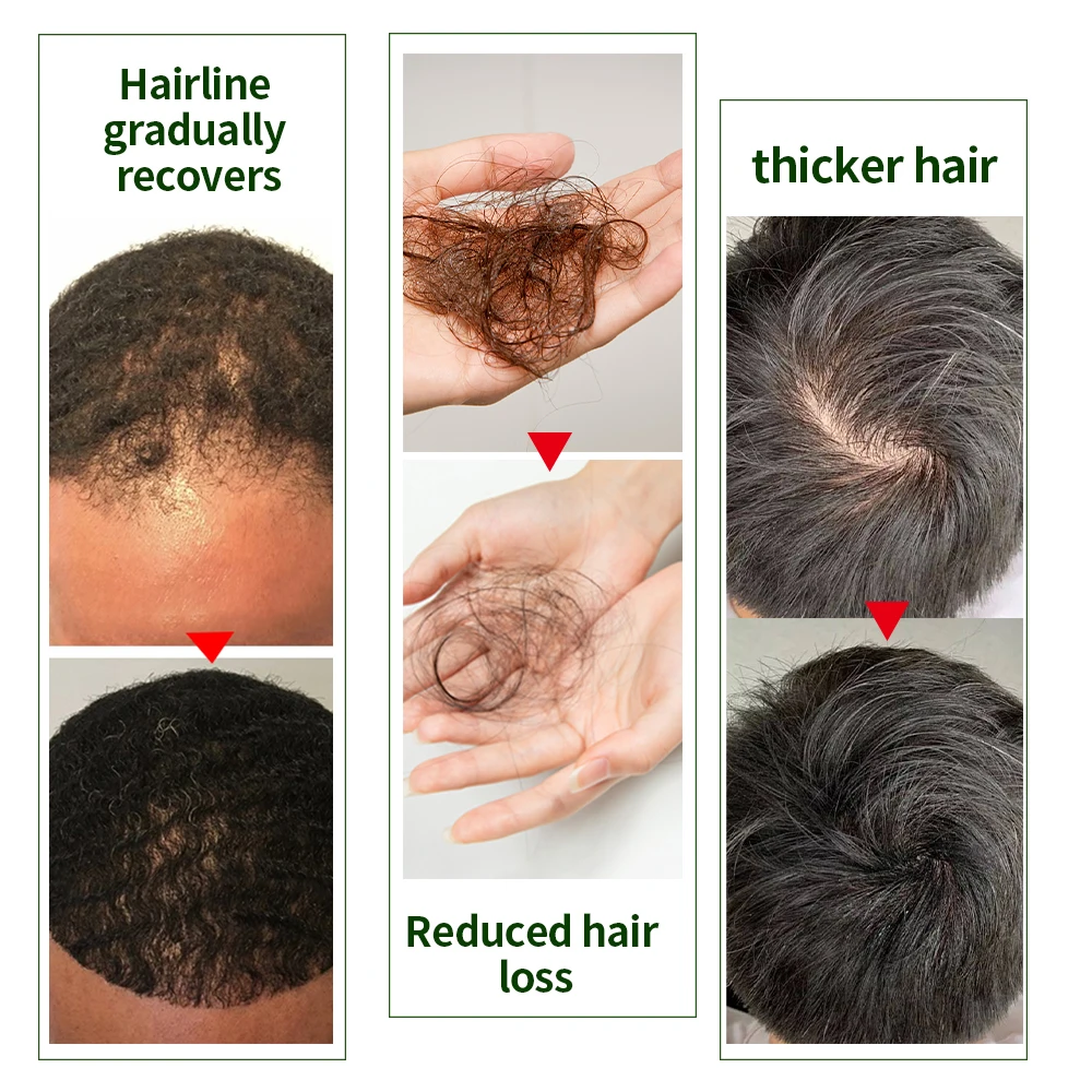 Oem Ginger Hair Growth Serum Natural Organic Custom Hair Care Hair Loss ...