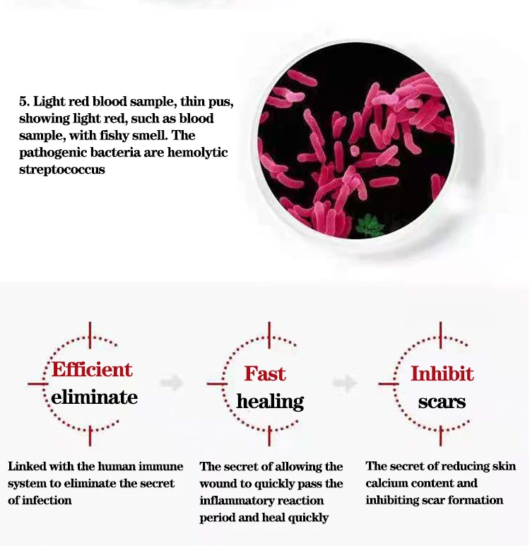 High-quality Silver Ion Wound Dressing Vaginal Gel With Silver Iones ...