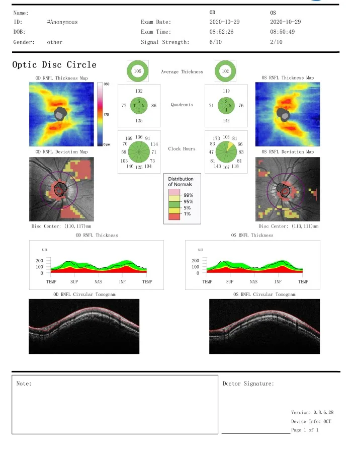 Ophthalmology Eye Ocular Coherence Tomography OCT-500