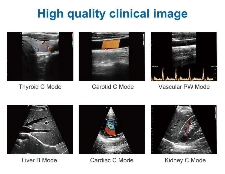 Small Size Handheld Doppler Ultrasound Scanner - 3 in 1