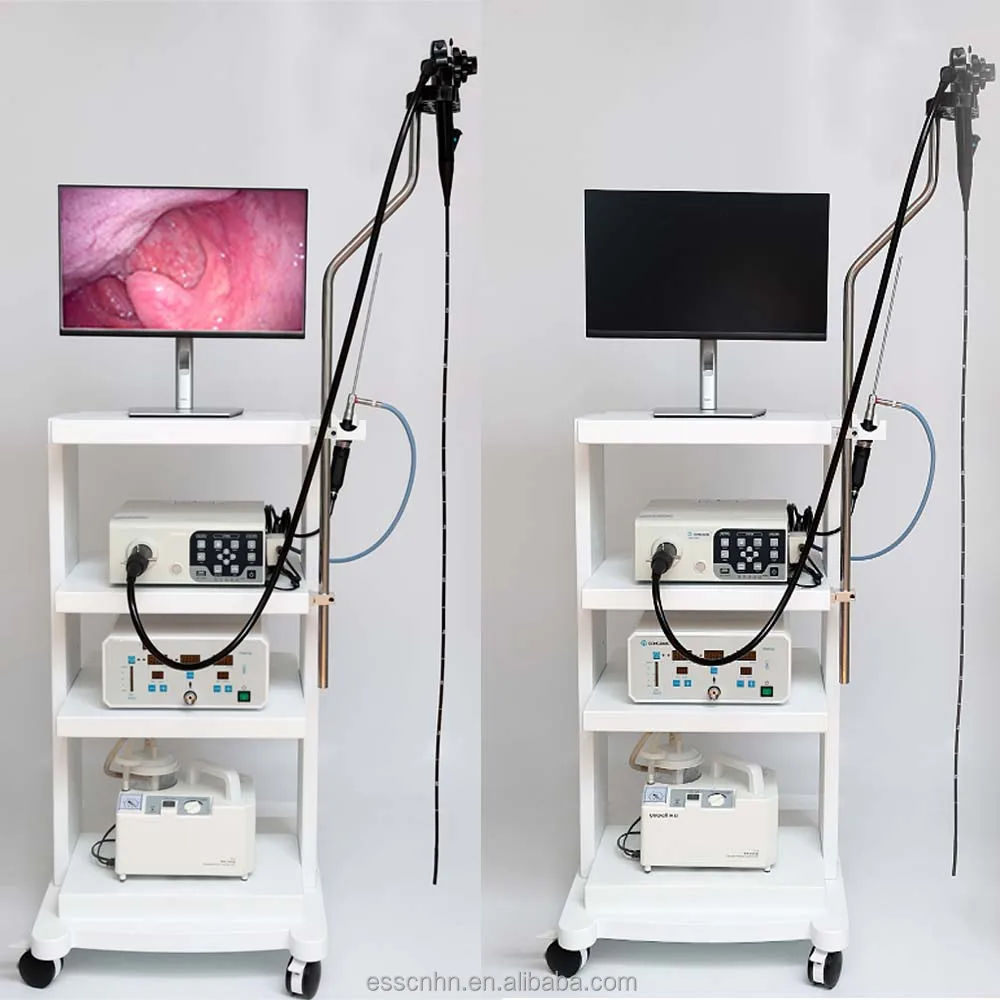 Factory Price Portable Usb Endoscopic Camera Veterinary Big Animal ...