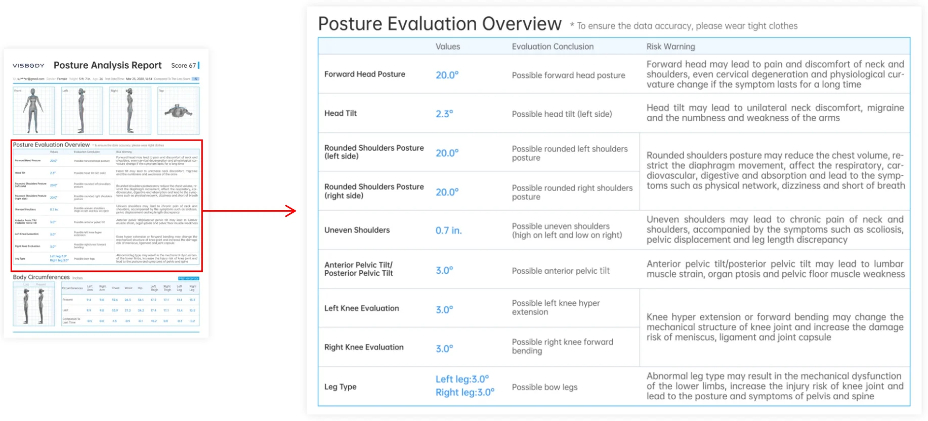 Visbody 3d Body Composition Analyzer And Posture Analysis Machine Bia ...