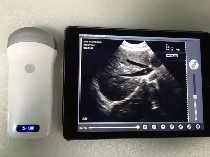 Veterinary Wireless Portable Type B-ultrasound Handheld Portable Color ...