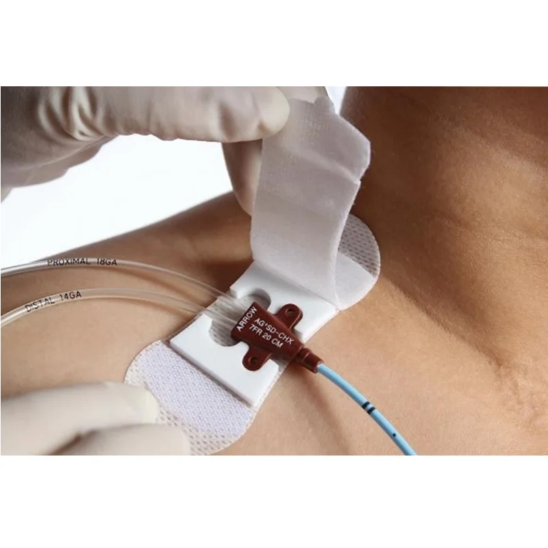 IV Cannula Fixing - Reliable PICC CVC Stabilization Paste