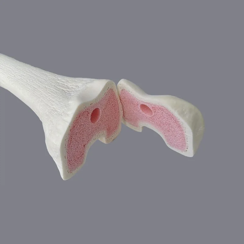 KyrenMed Sawbones Foam Knee with Fibula and Two Stretch Cord Ligaments ...