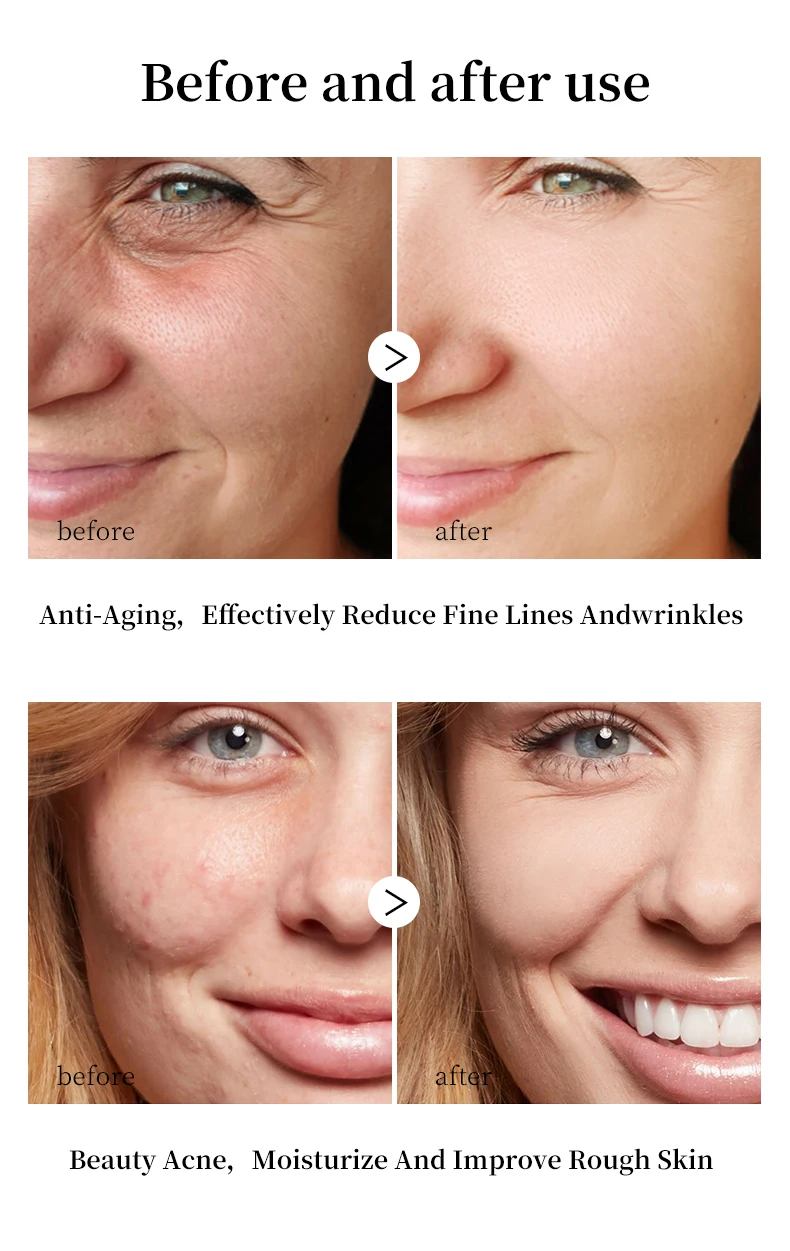 Retinol Facial Serum - Anti-Aging, Firming, and Brightening