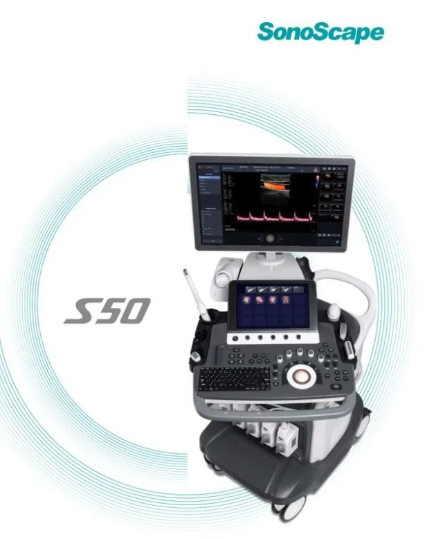 Sonoscape S60 - High Performance 4D Color Doppler Ultrasound