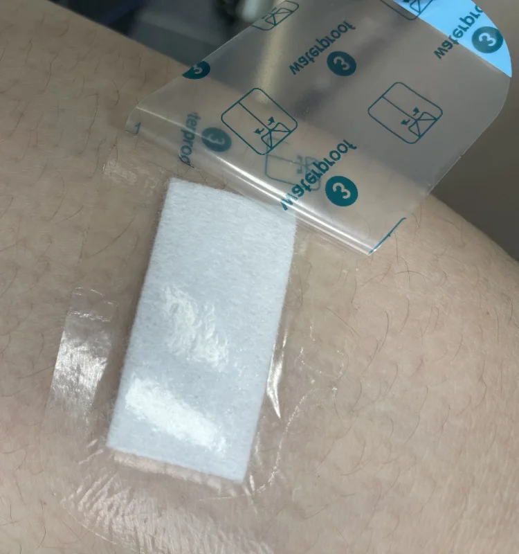 Waterproof Self Adhesive Wound Dressing with Absorbent Pad