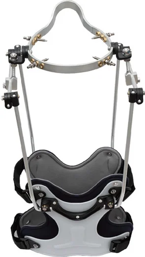 Hot New Type Aluminium 3-point Head Frame Brain Mayfield Pattern Pin ...