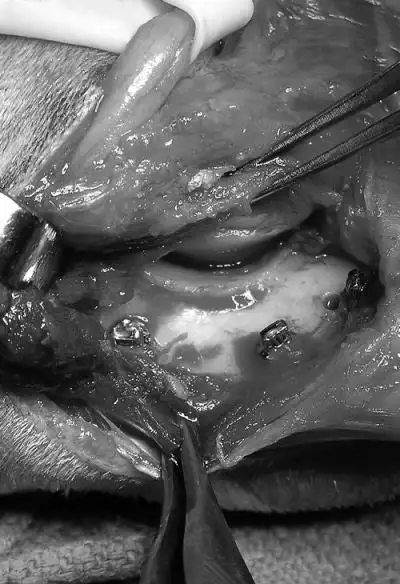 Titanium Anchors for Ligament Joint Repair - Durable Orthopedic ...